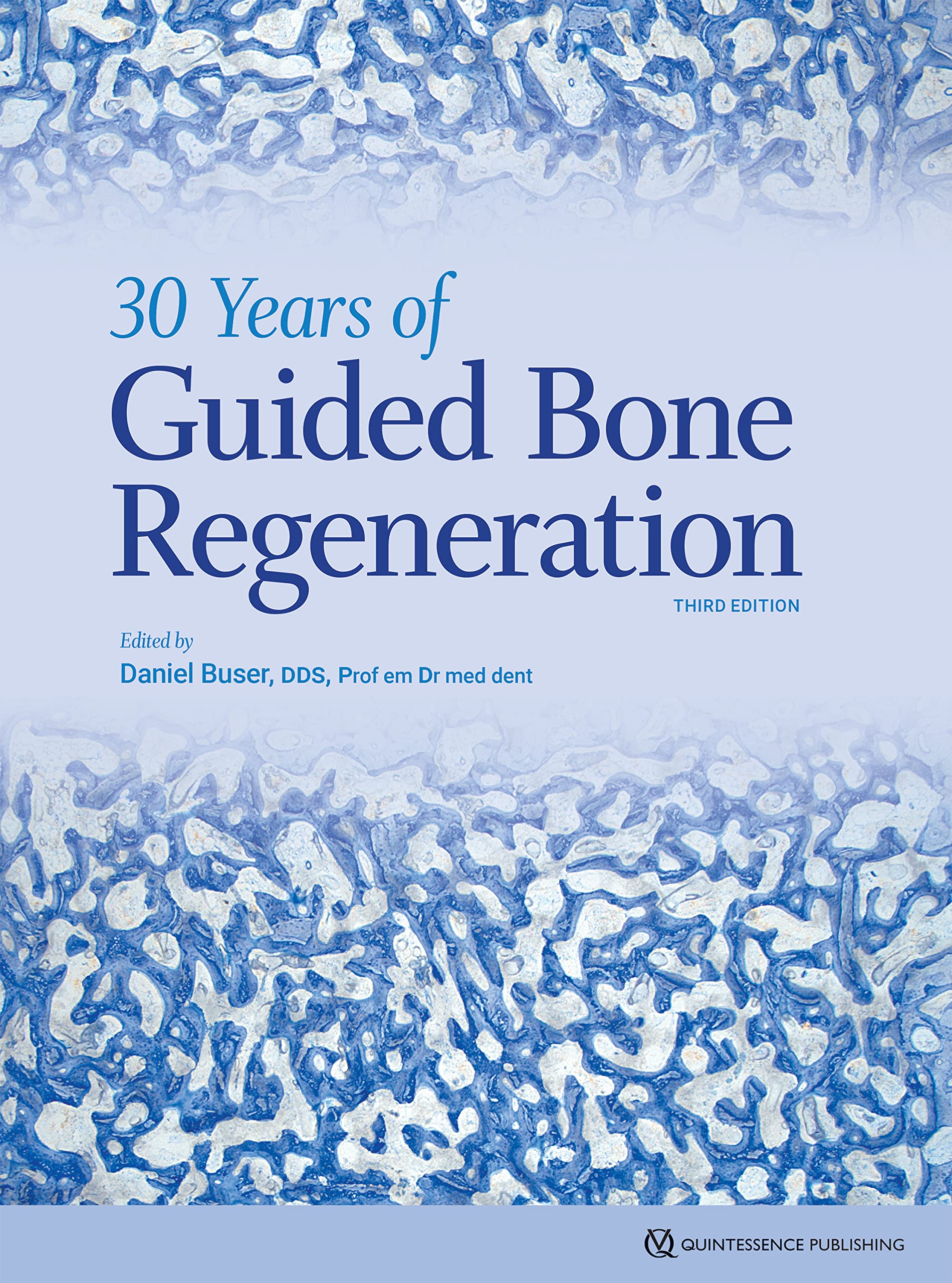 30 Years of Guided Bone Regeneration: Third edition by Daniel Buser ...