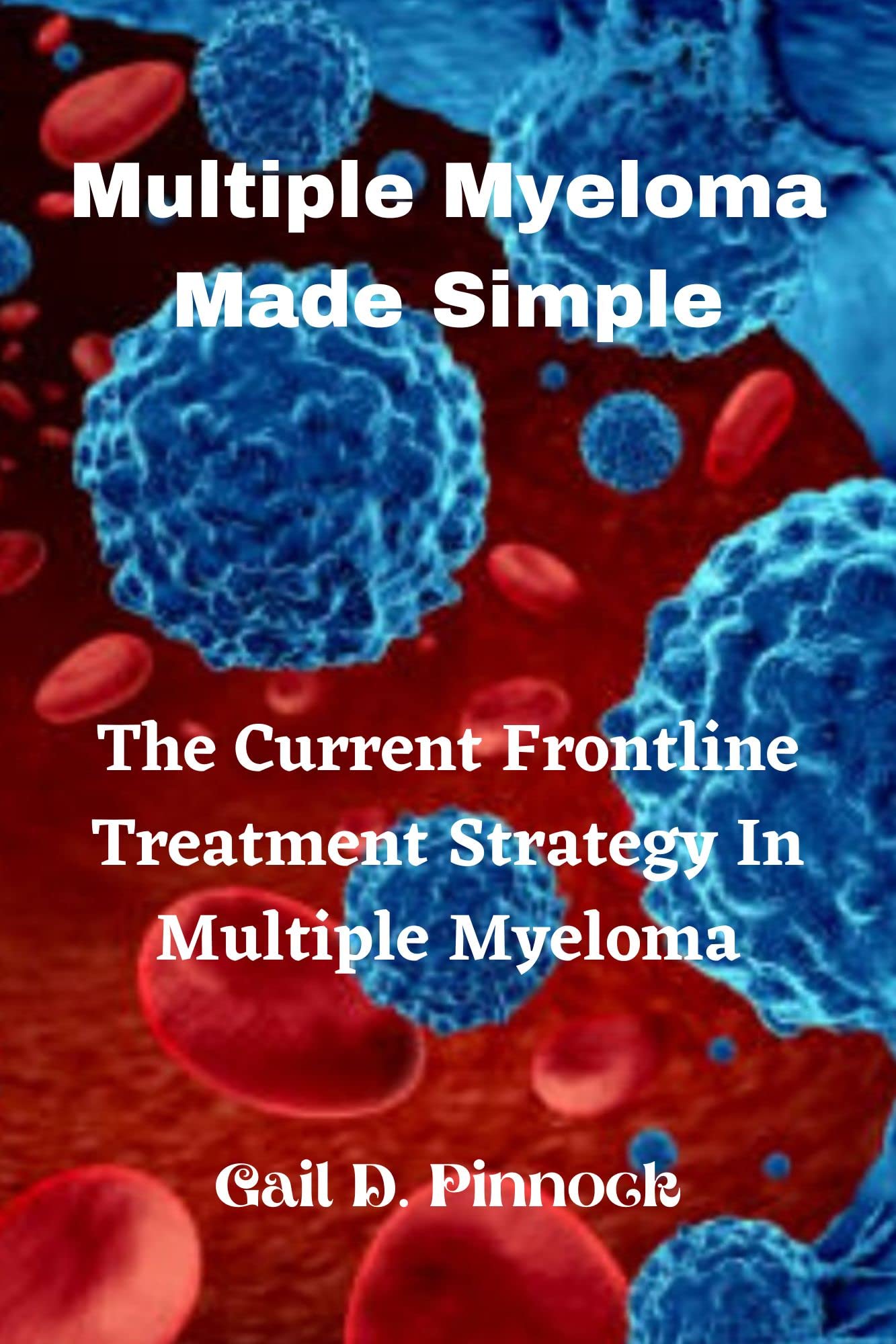 Multiple Myeloma Made Simple: The Current Frontline Treatment Strategy In Multiple Myeloma by ...