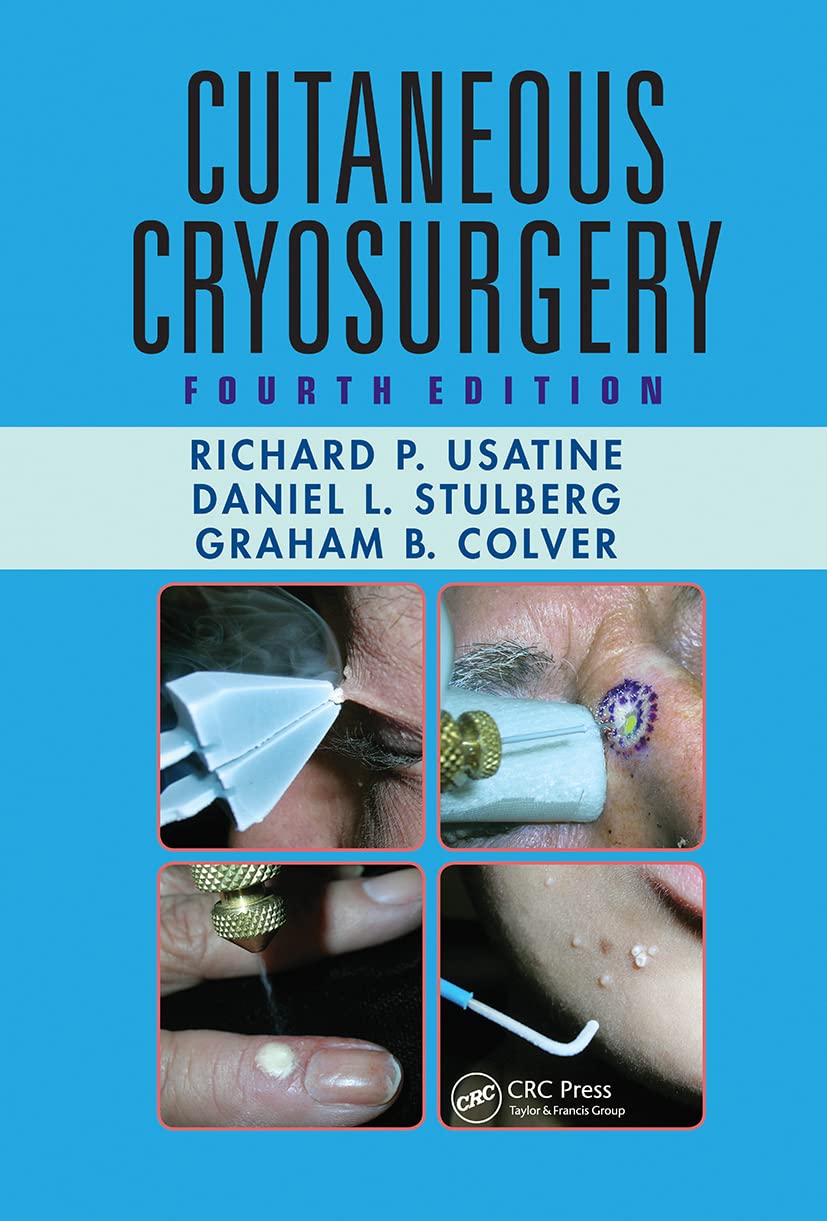 Cutaneous Cryosurgery: Principles and Clinical Practice by Richard P ...