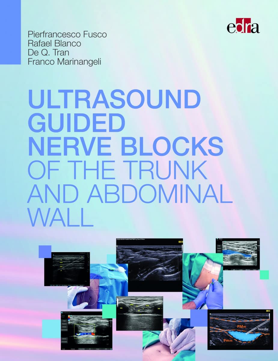 Ultrasound-guided nerve blocks of the trunk and abdominal wall by ...