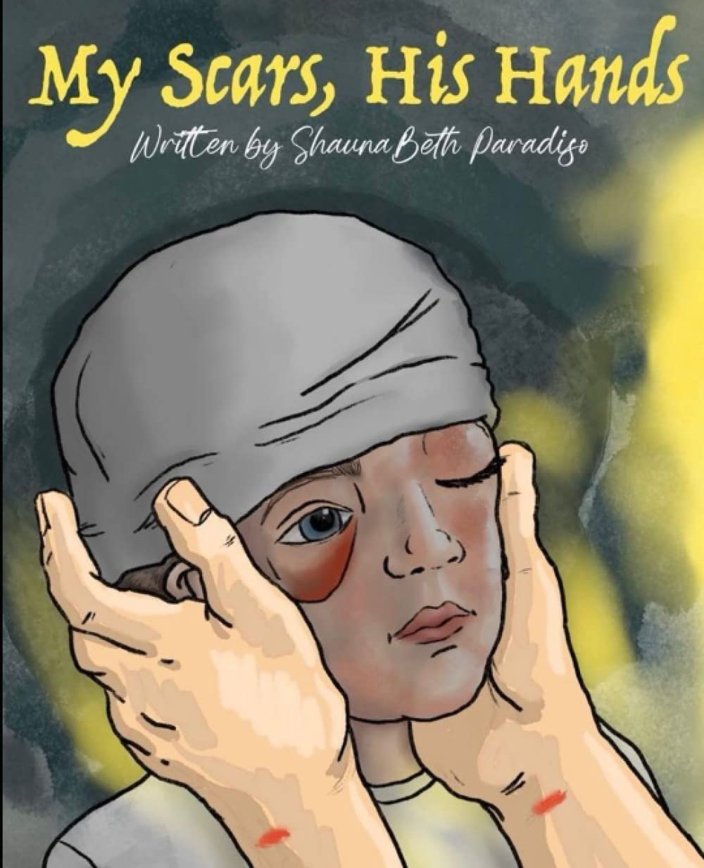 My Scars His Hands: How He healed my physical and emotional scars and ...