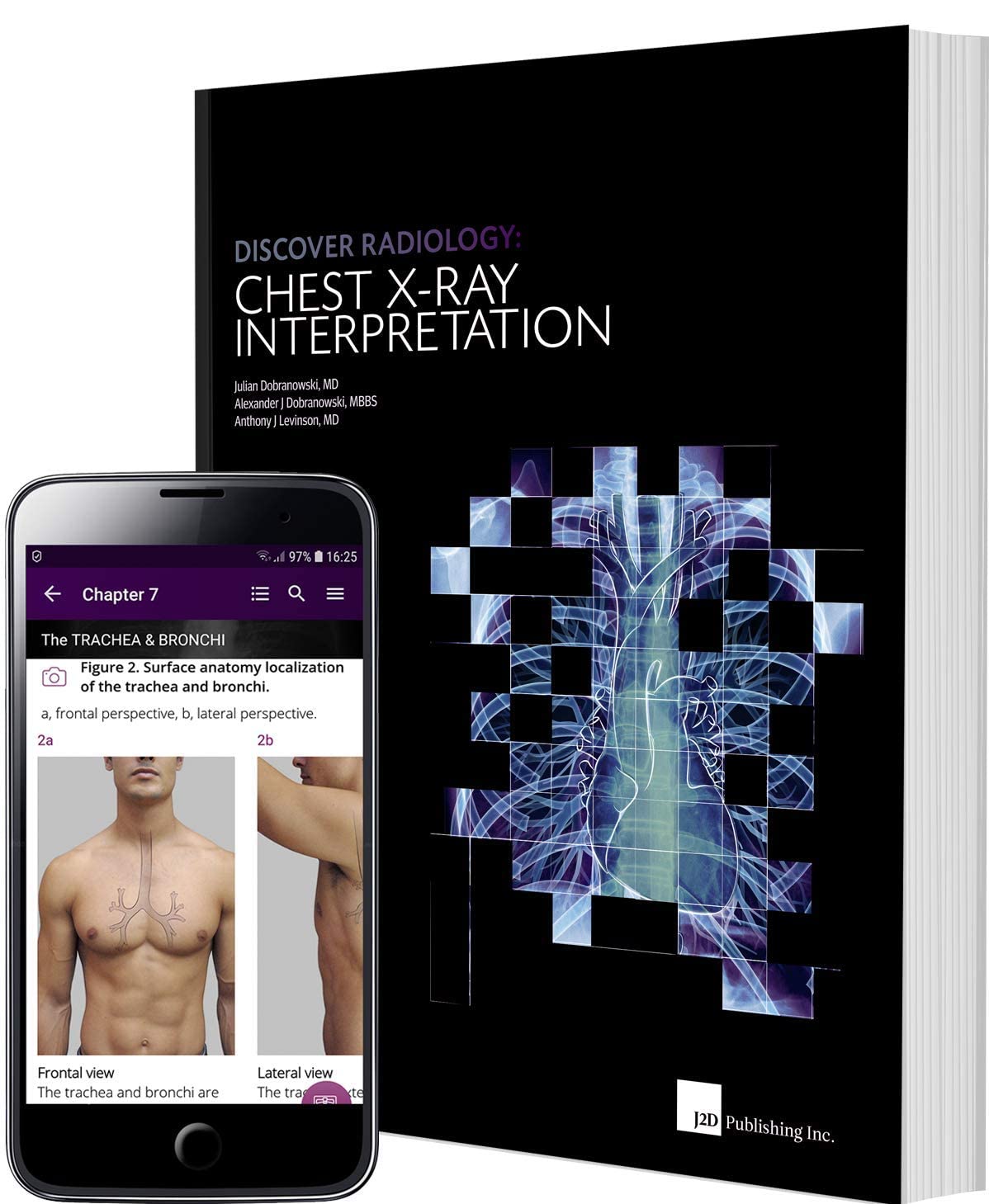 Discover Radiology Chest X-Ray Interpretation Book for Medical Student ...