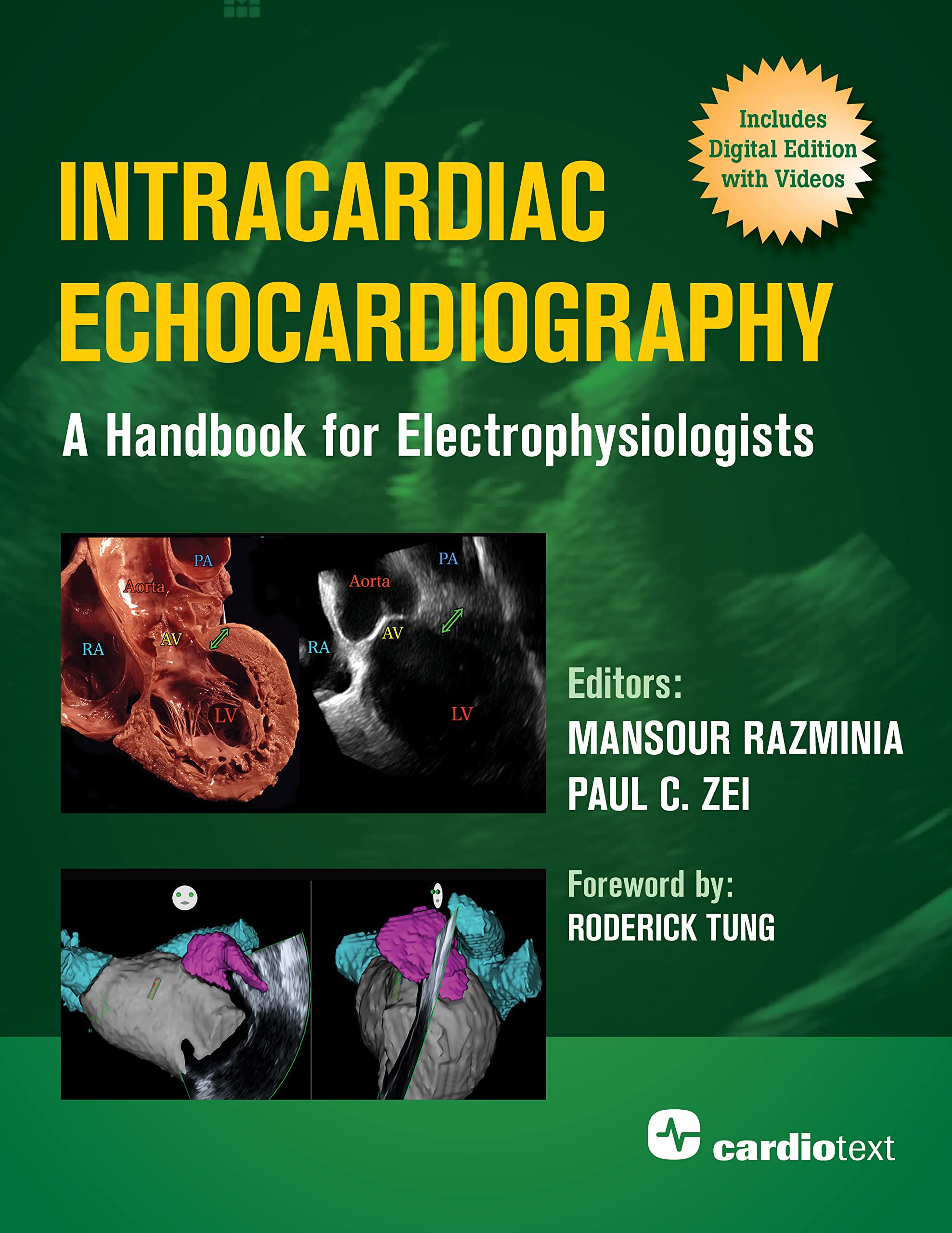 Intracardiac Echocardiography: A Handbook for Electrophysiologists by Mansour Razminia | Goodreads