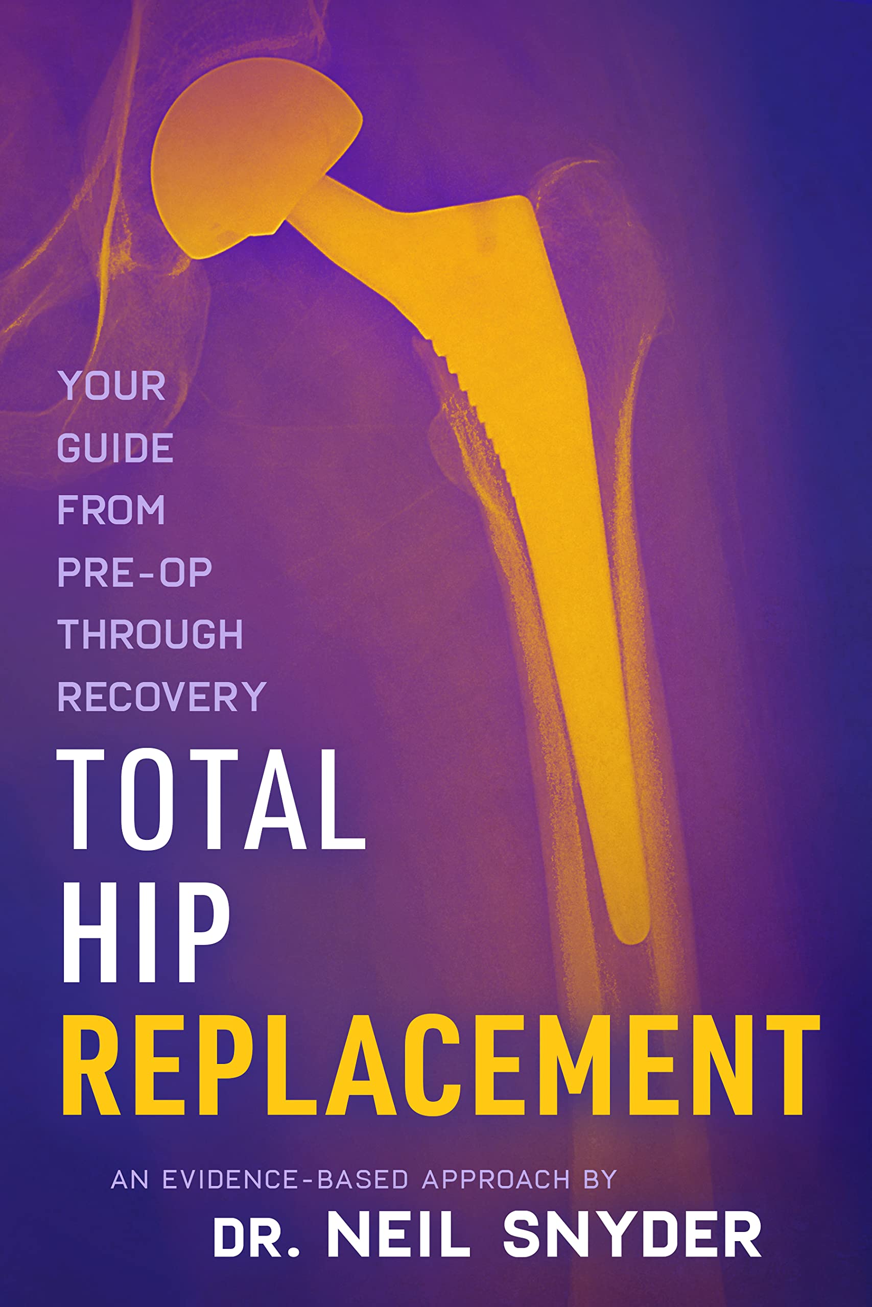 Total Hip Replacement: An Evidence-Based Approach Your Guide From Pre ...