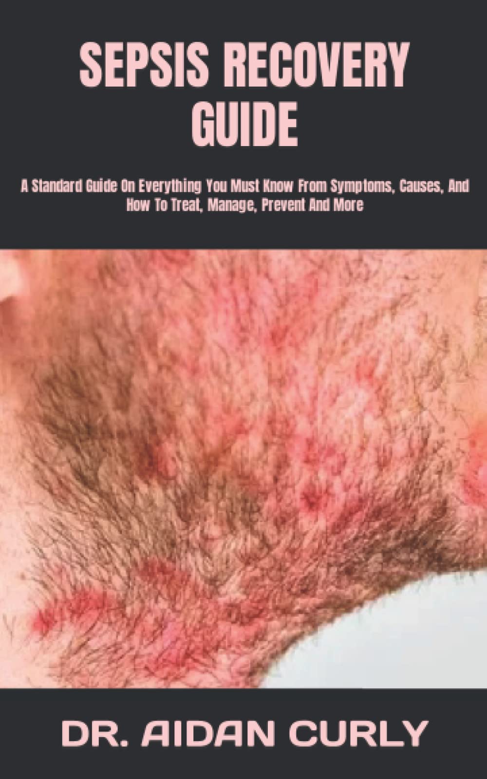 SEPSIS RECOVERY GUIDE: A Standard Guide On Everything You Must Know ...