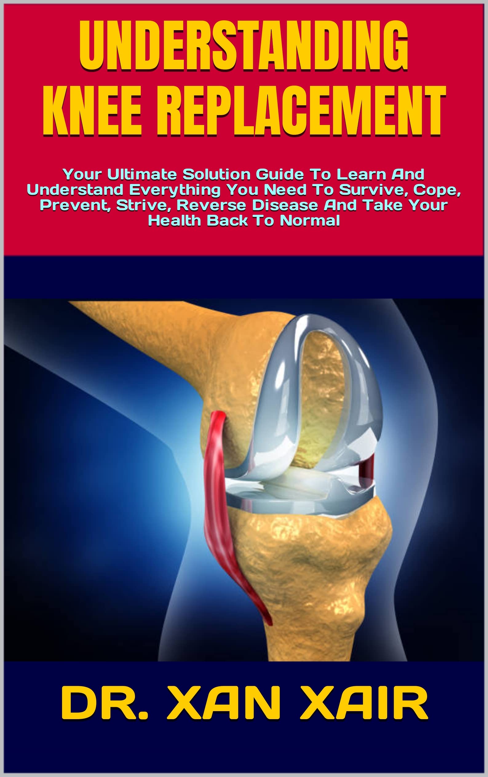 UNDERSTANDING KNEE REPLACEMENT : Your Ultimate Solution Guide To Learn ...
