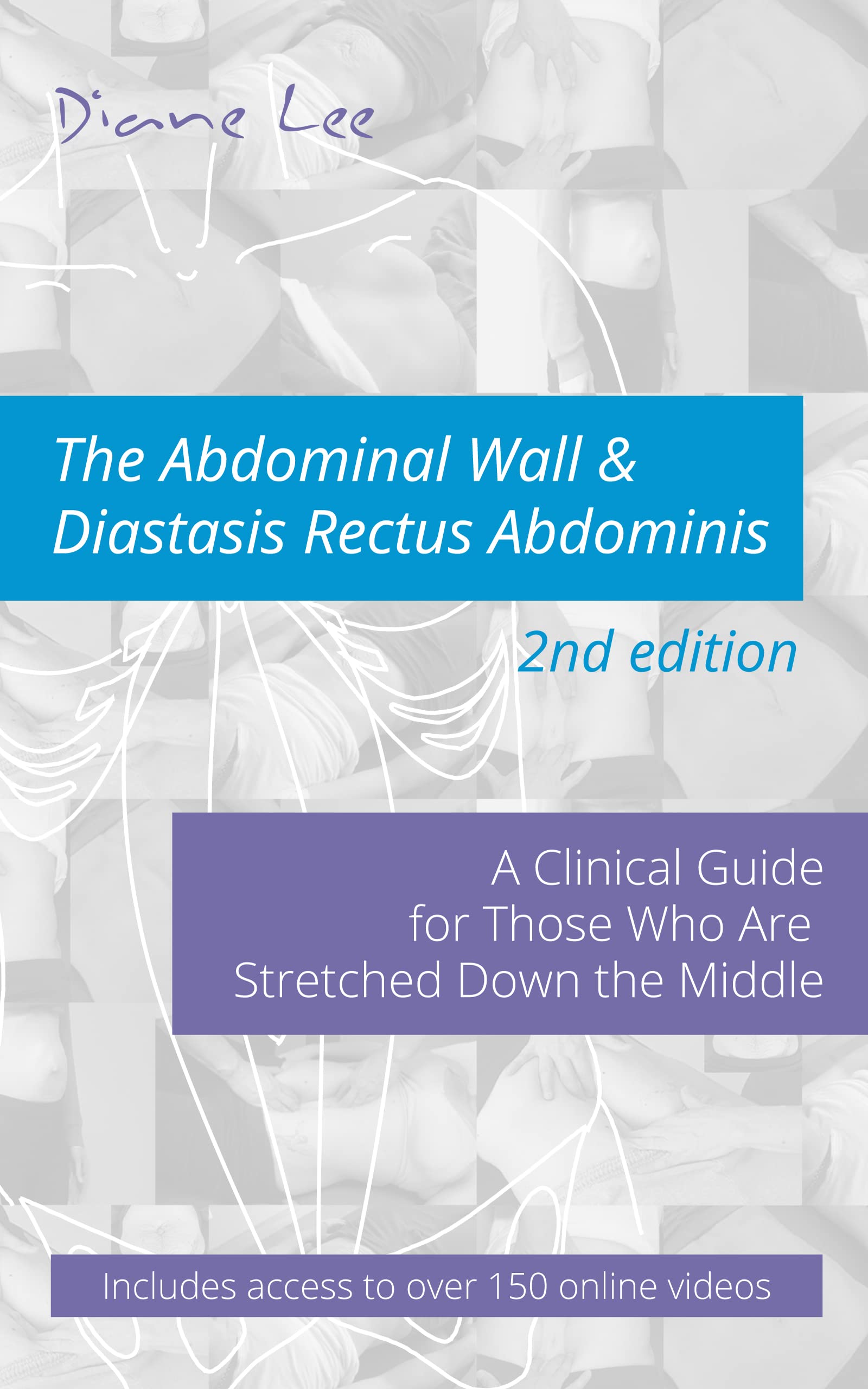 The Abdominal Wall & Diastasis Rectus Abdominis, 2nd edition: A ...