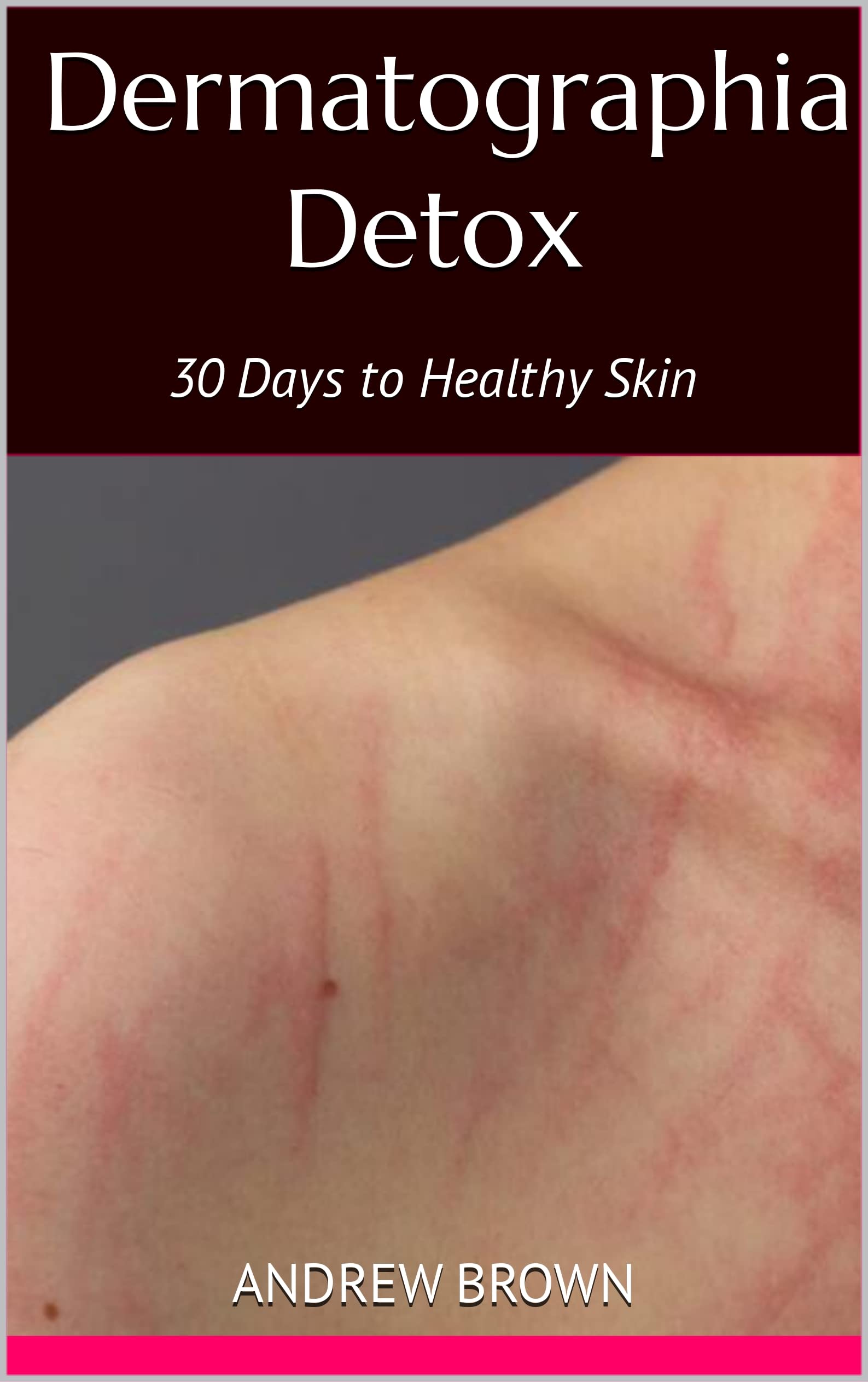 Dermatographia Detox: 30 Days to Healthy Skin by Andrew Brown | Goodreads