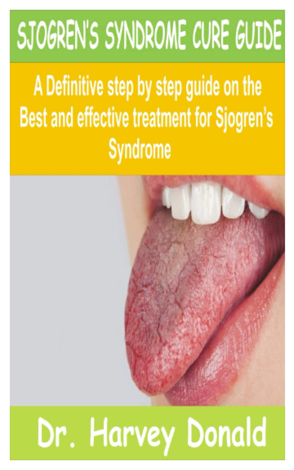 SJOGREN’S SYNDROME CURE GUIDE: A Definitive step by step guide on the best and effective ...