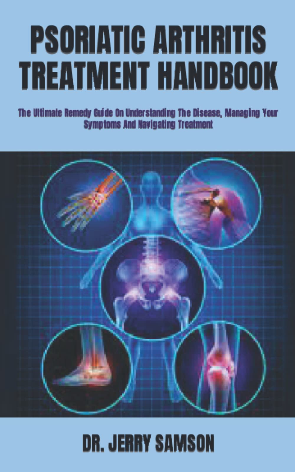 PSORIATIC ARTHRITIS TREATMENT HANDBOOK: The Ultimate Remedy Guide On Understanding The Disease ...