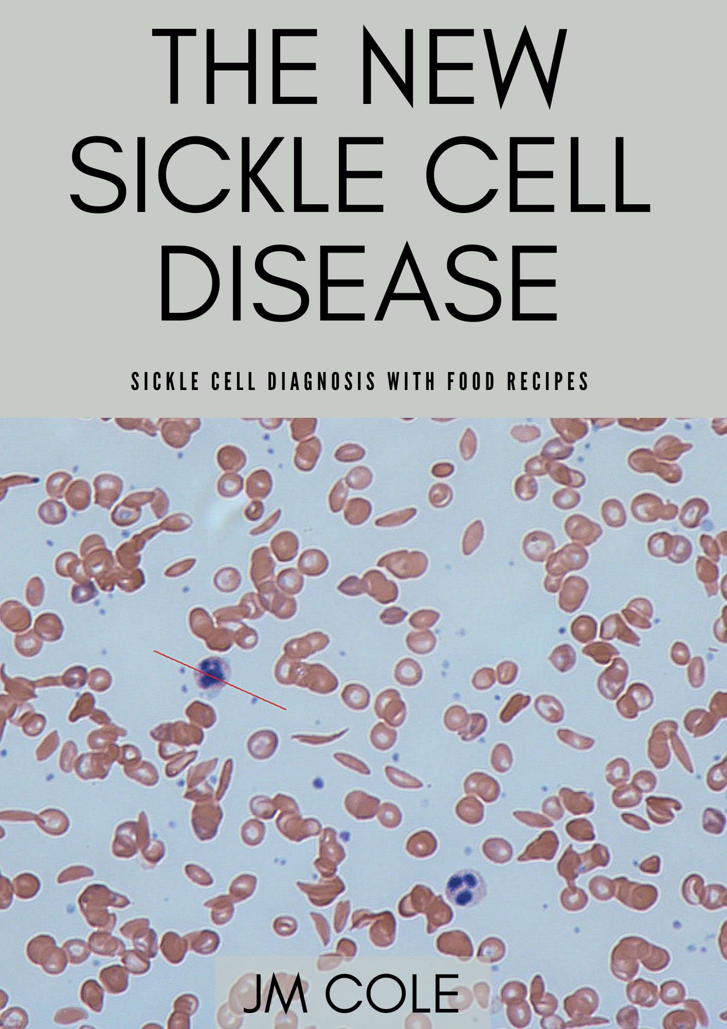 THE NEW SICKLE CELL DISEASE: SICKLE CELL DIAGNOSIS WITH FOOD RECIPES by ...
