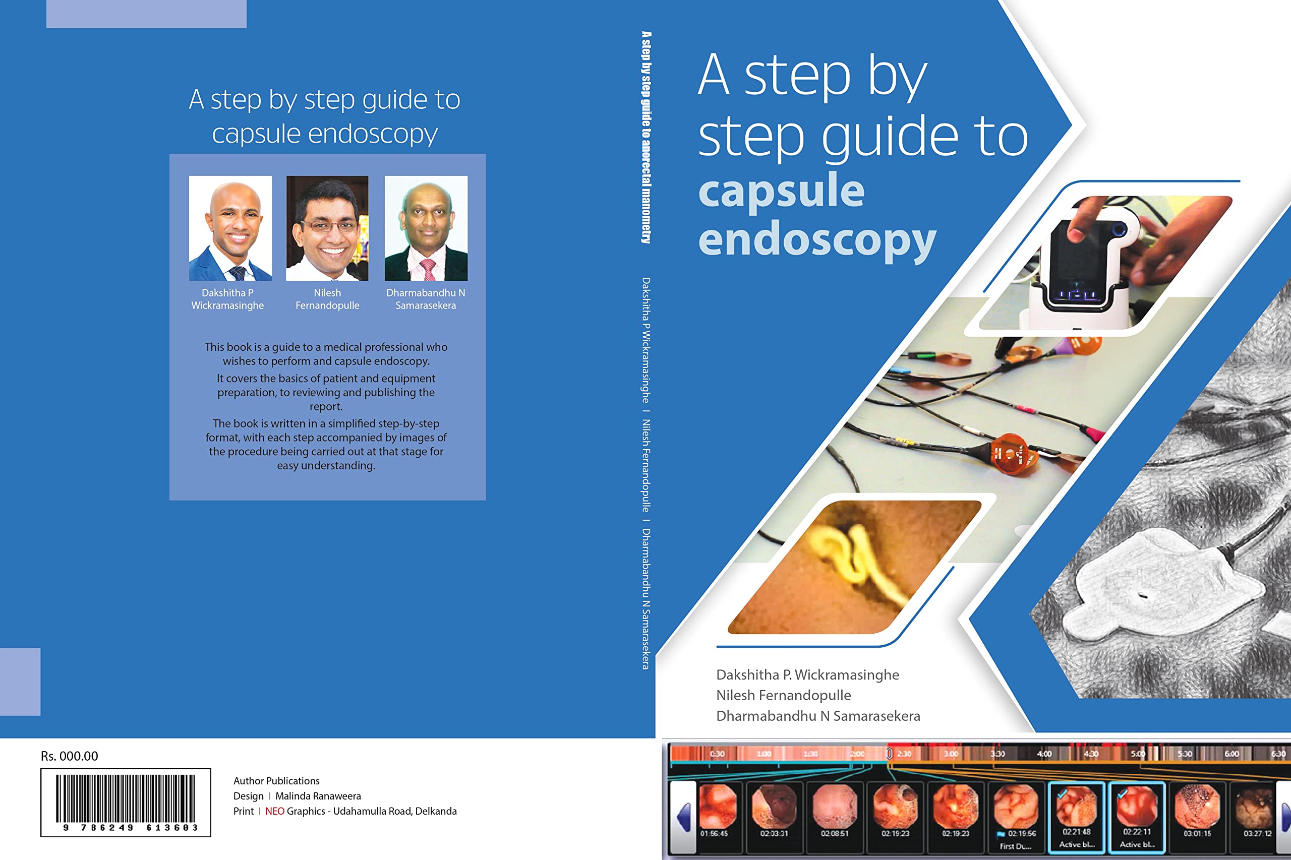 A step by step guide to capsule endoscopy by Dakshitha Wickramasinghe ...