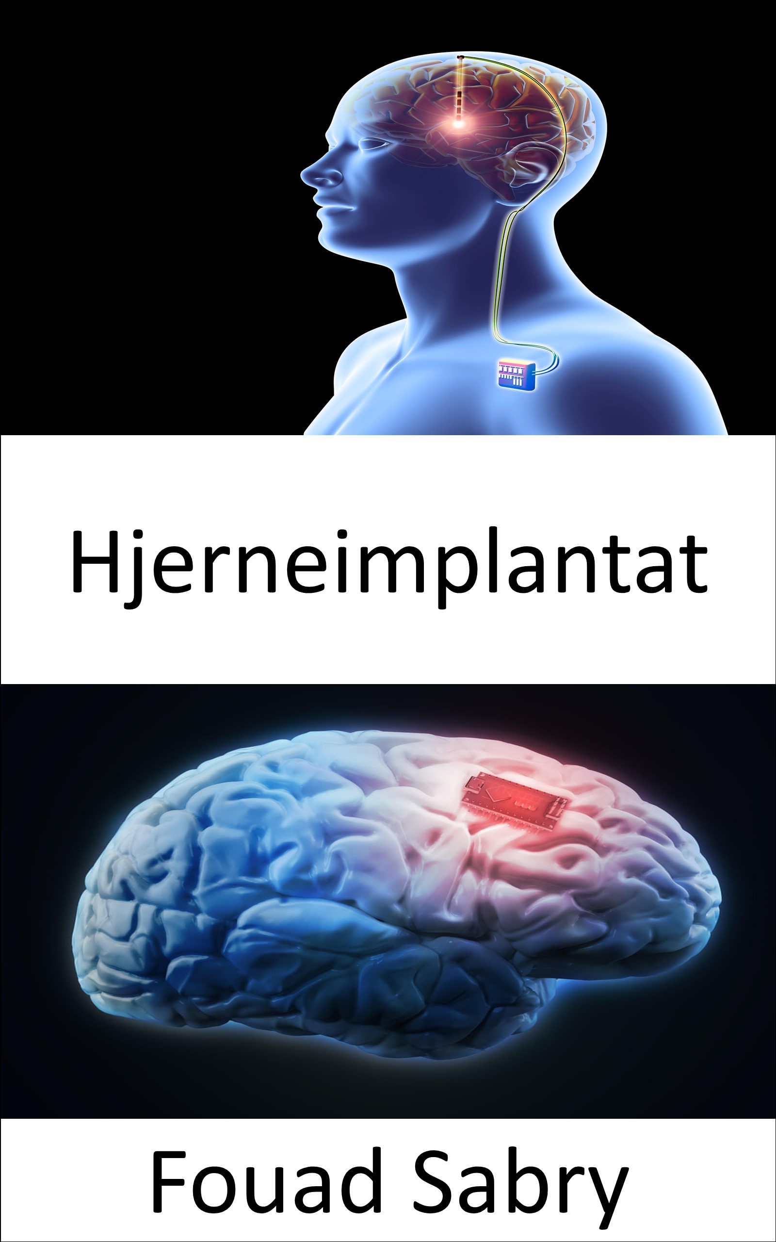 Hjerneimplantat: Forskningen som støtter Neuralink, Elon Musks ...