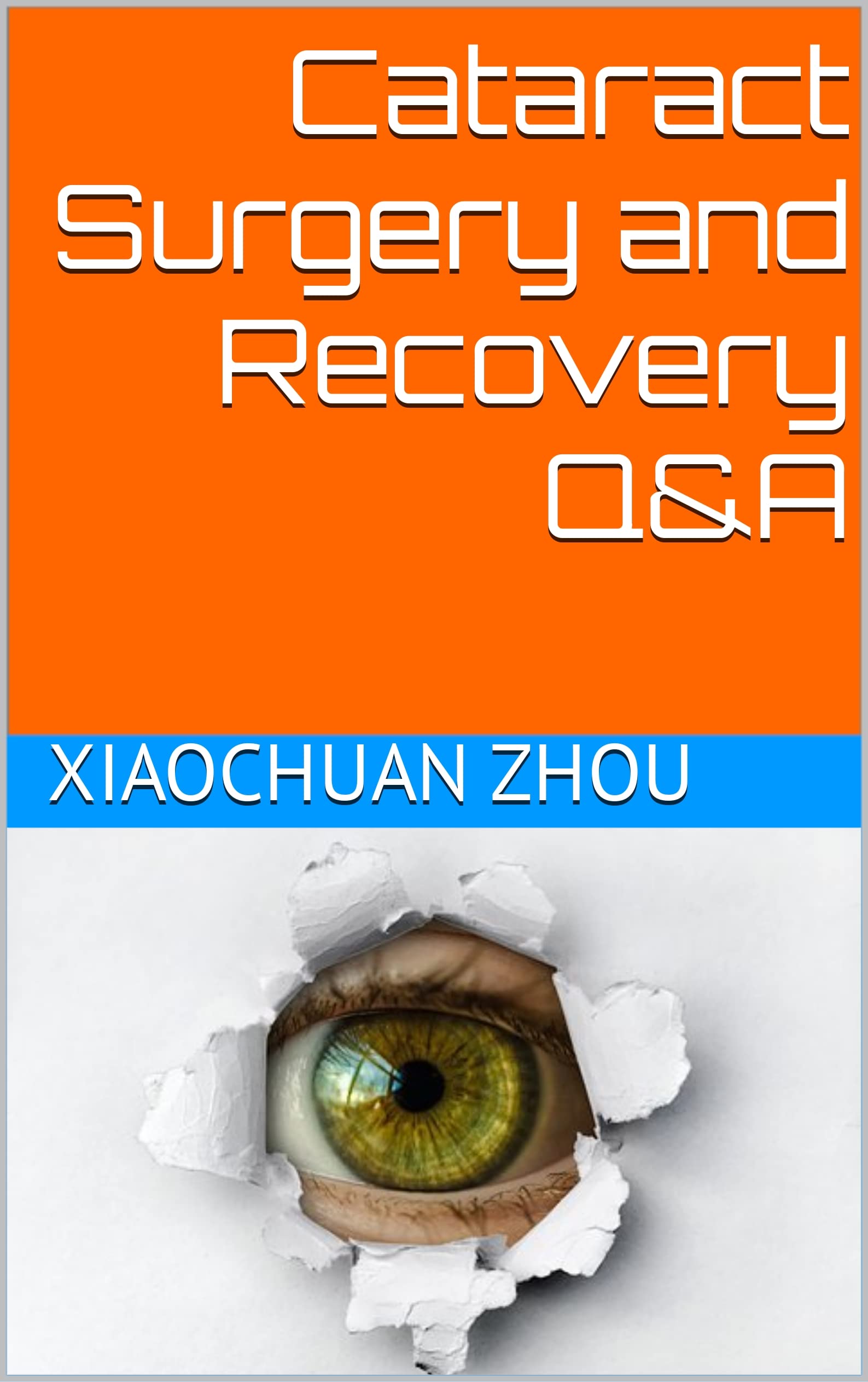 Cataract Surgery and Recovery Q&A by MR. XIAOCHUAN ZHOU | Goodreads