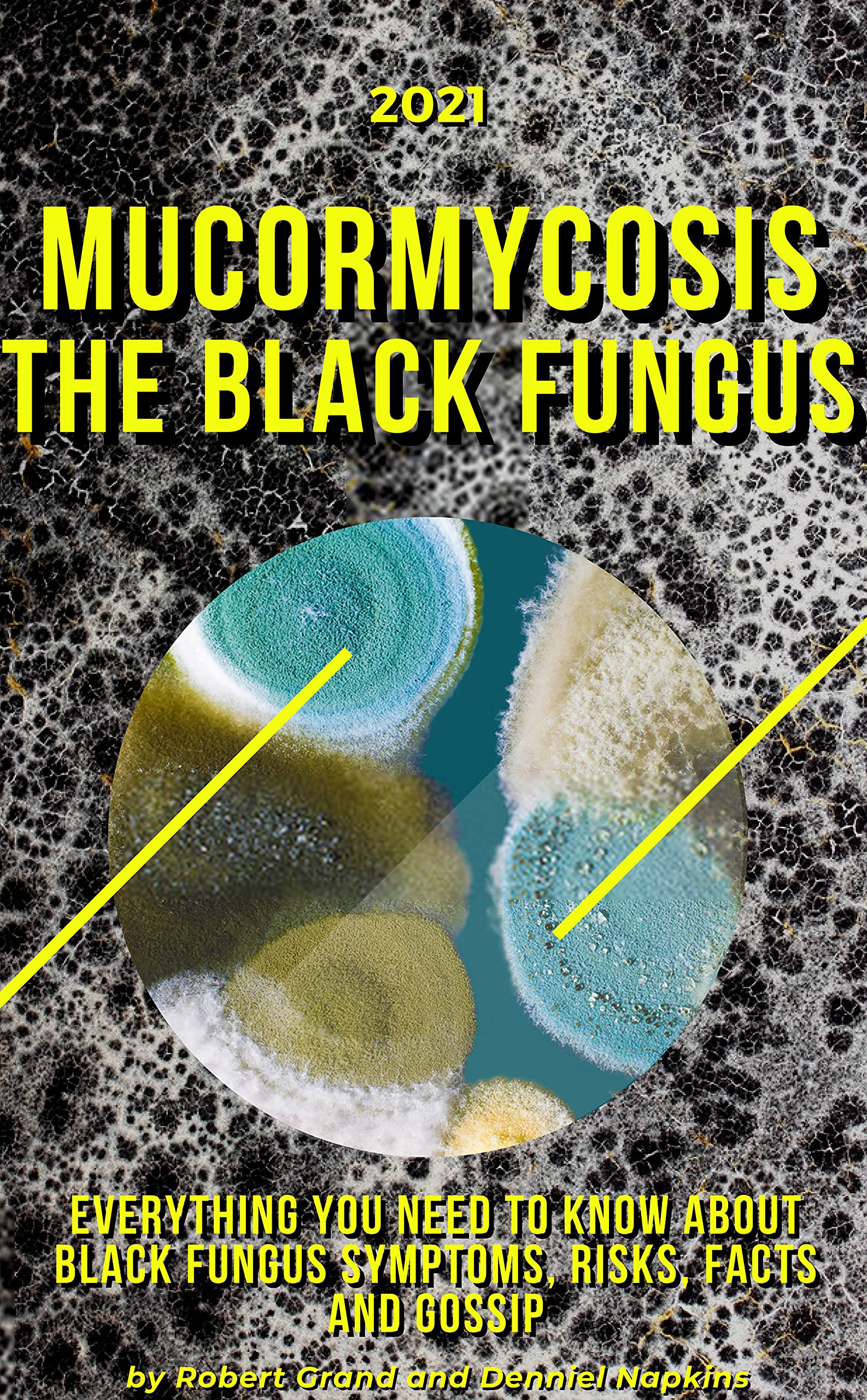 Mucormycosis. The Black Fungus: 2021 Everything You Need to Know About ...