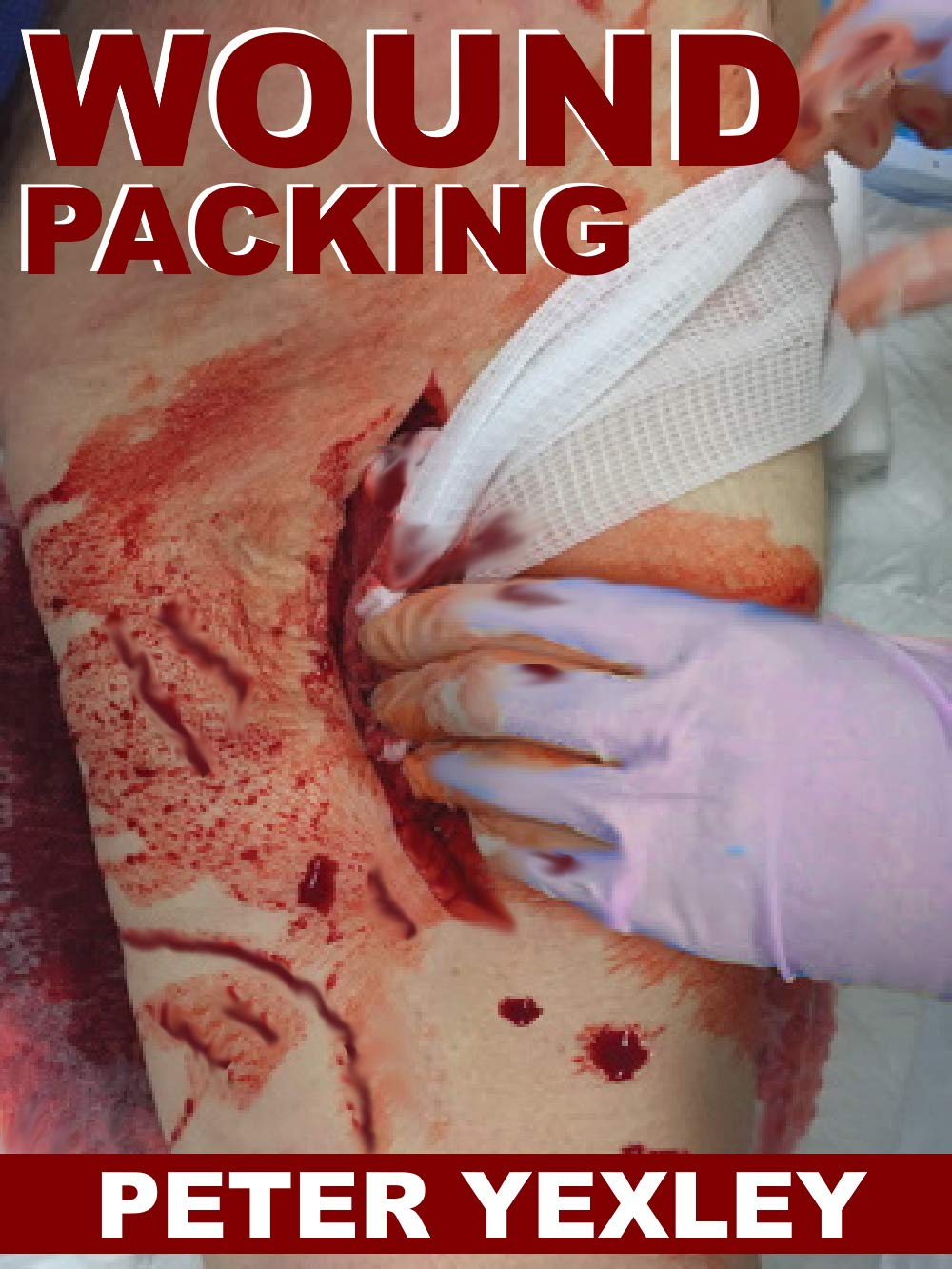 Wound Packing - Stopping the Bleed by Peter Yexley | Goodreads