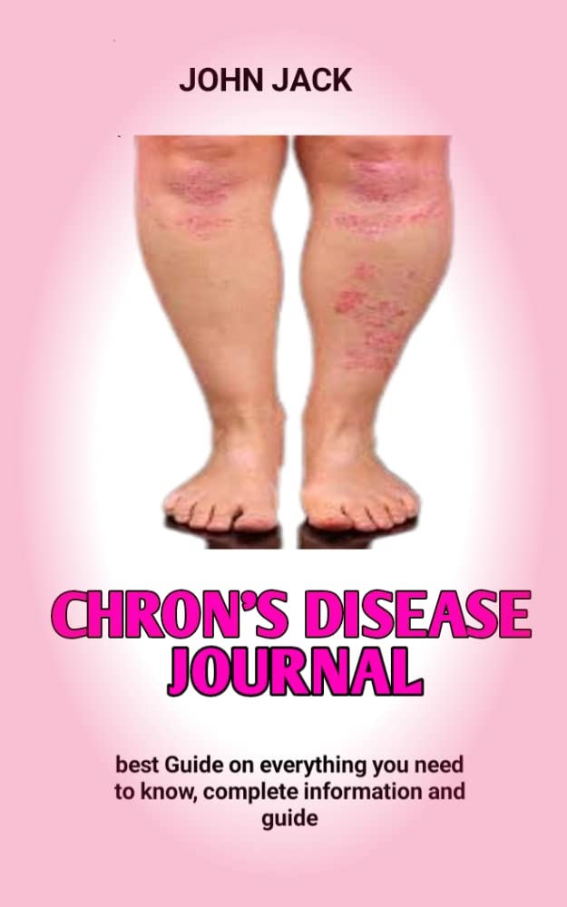 Chrons Disease Journal Chrons Disease Journal Strategies To Manage Chrons Disease By Dr