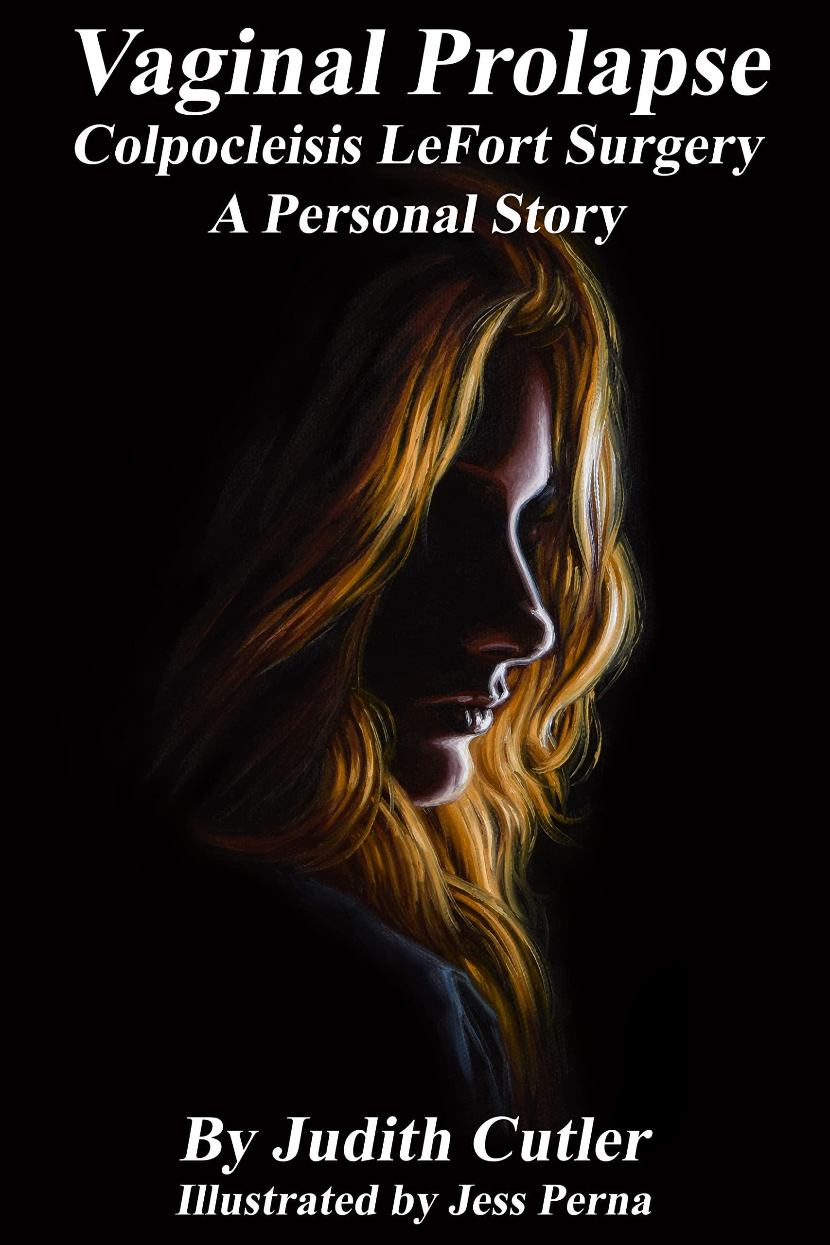 Vaginal Prolapse | Colpocleisis LeFort Surgery: A Personal Story by ...