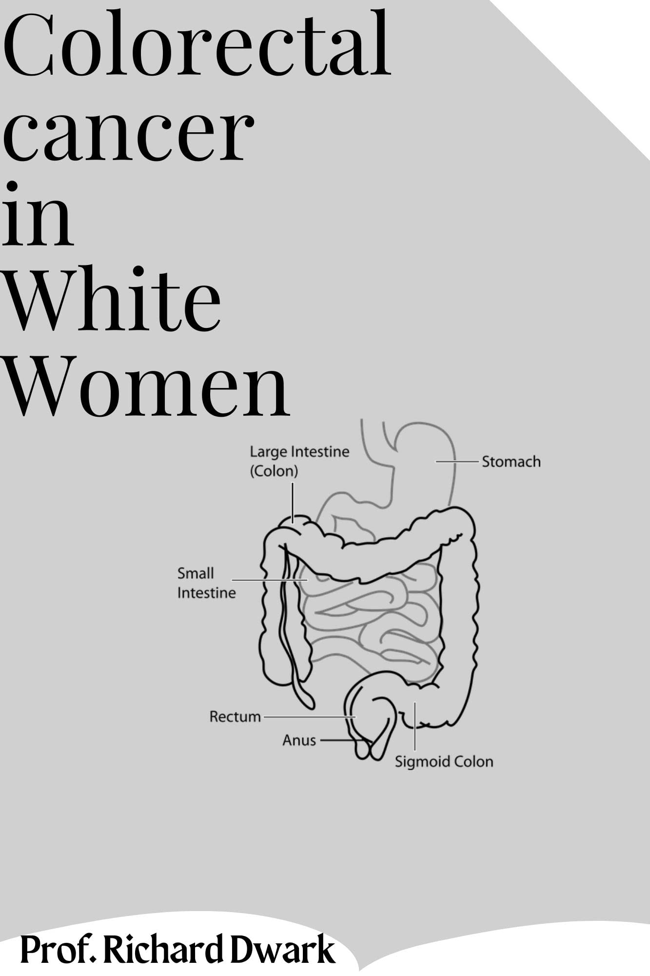 Colorectal Cancer in White Women: Deadly Signs, Symptoms & Causes of ...