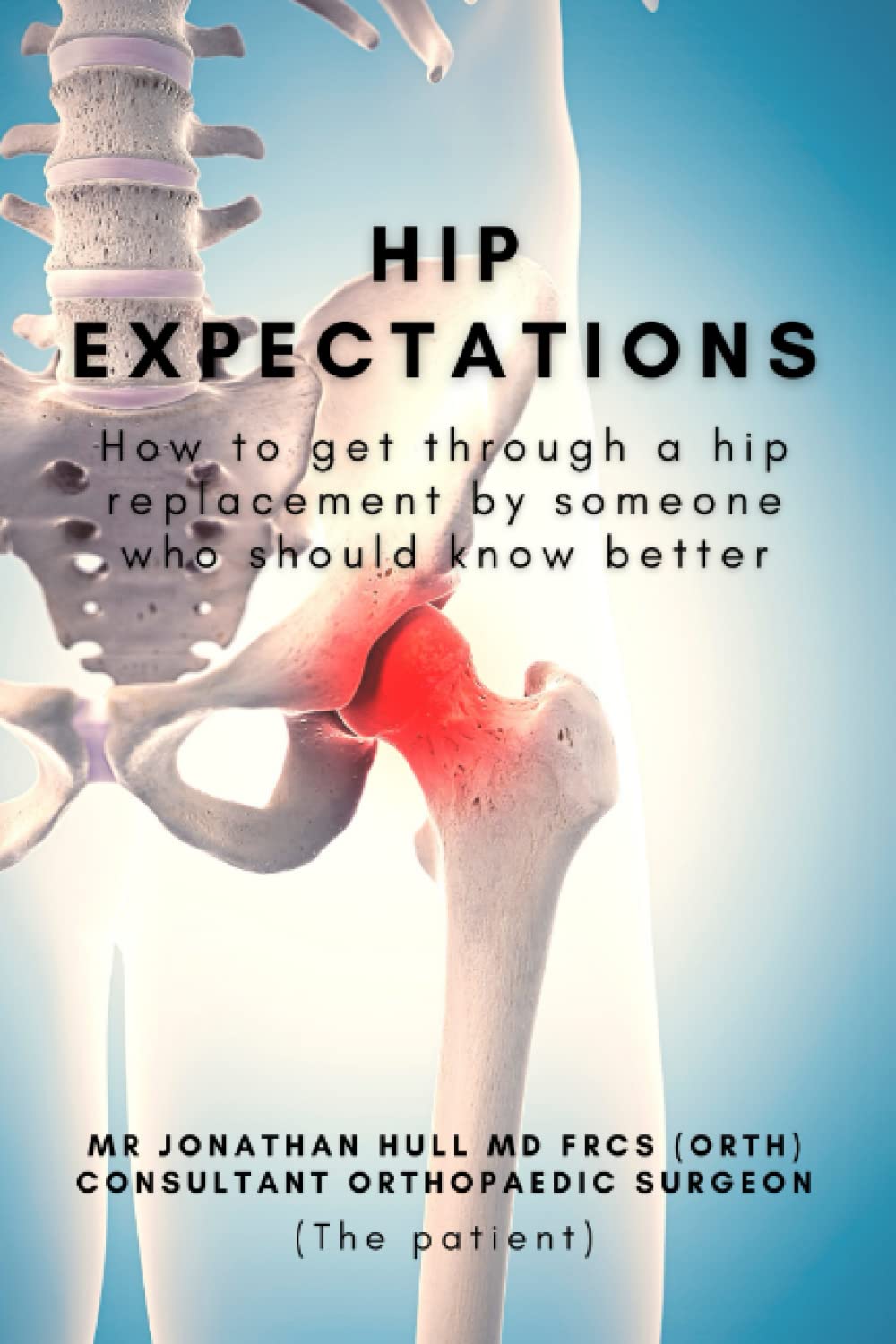 Hip Expectations: How to get through a hip replacement by someone who ...