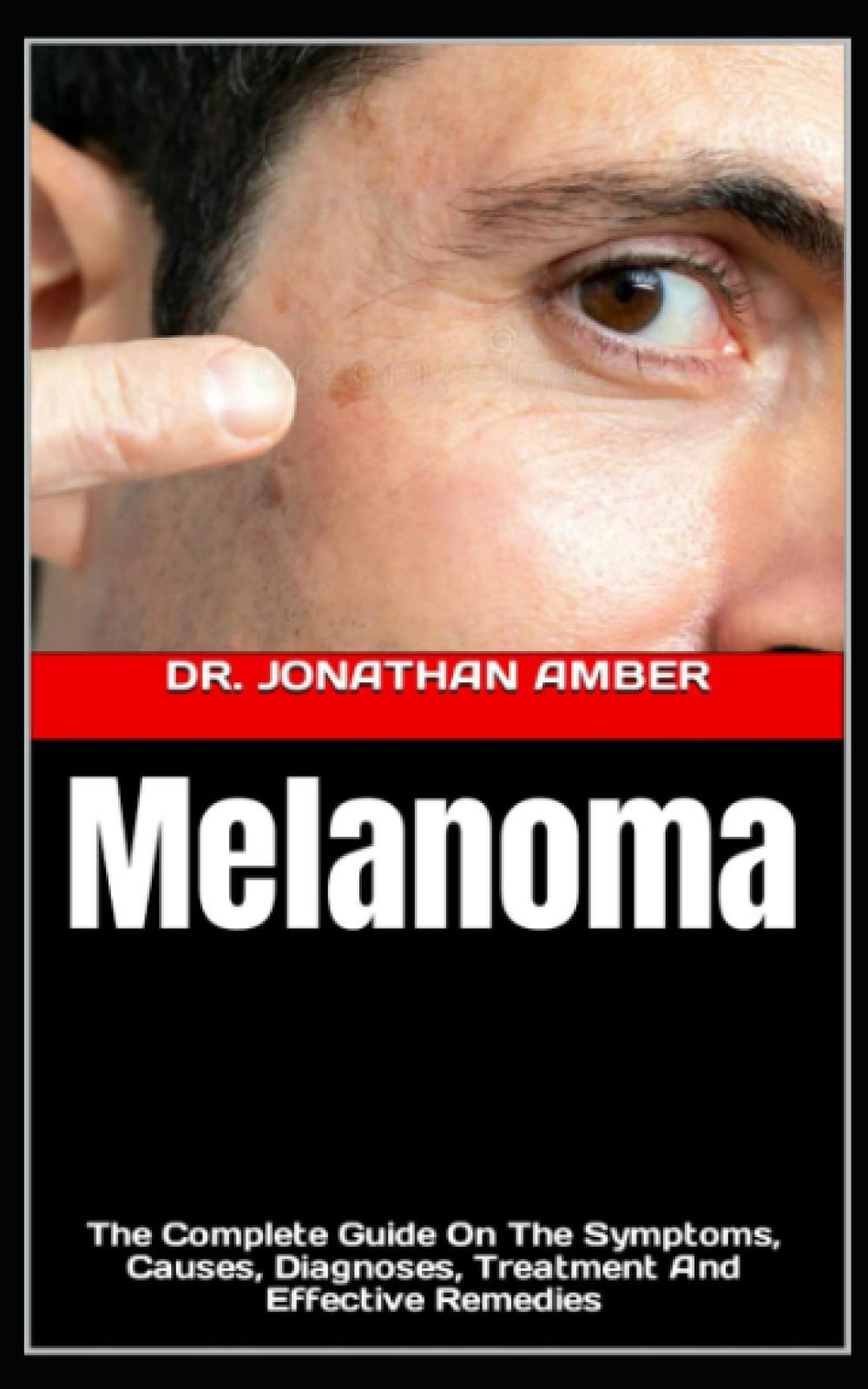 Melanoma: The Complete Guide On The Symptoms, Causes, Diagnoses ...