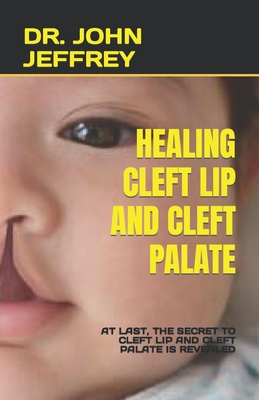 Healing Cleft Lip and Cleft Palate: At Last, the Secret to Cleft Lip ...