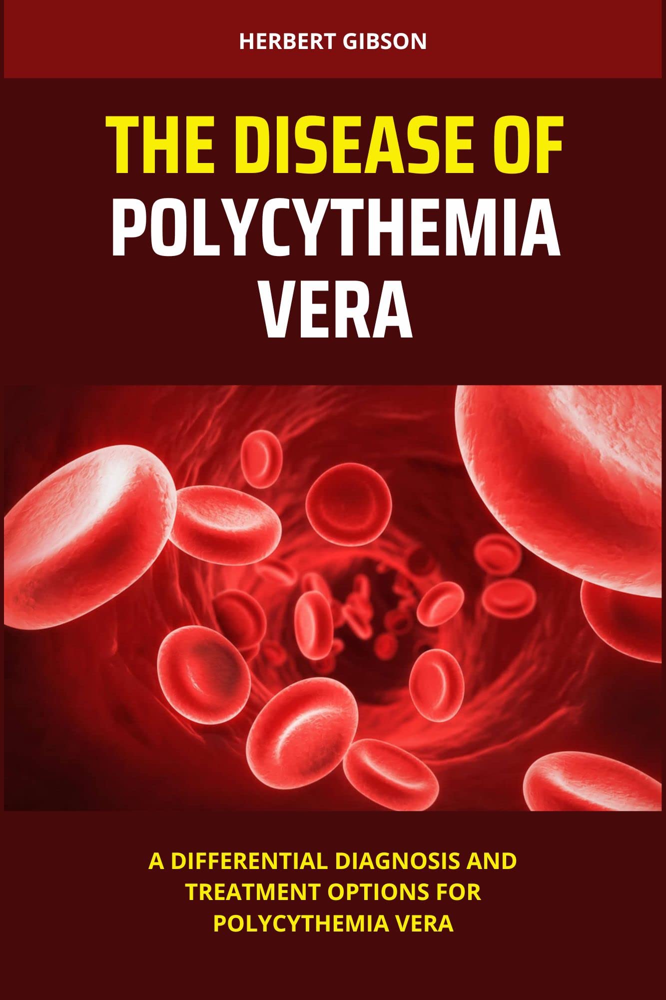 THE DISEASE OF POLYCYTHEMIA VERA: A differential diagnosis and treatment options for ...