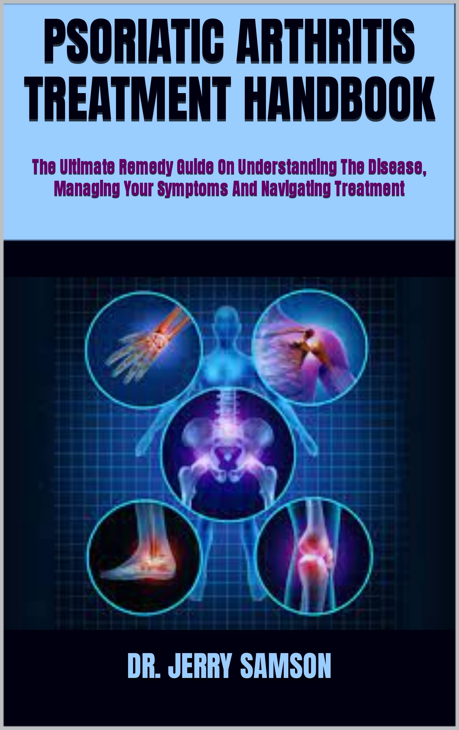 PSORIATIC ARTHRITIS TREATMENT HANDBOOK : The Ultimate Remedy Guide On ...