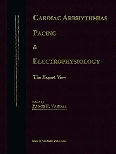 Cardiac Arrhythmias, Pacing & Electrophysiology: the Expert View by ...