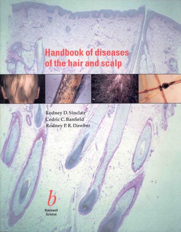 Handbook of Diseases of the Hair and Scalp by Rodney Sinclair | Goodreads