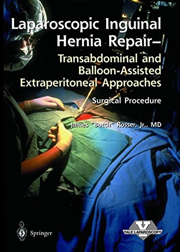 Laparoscopic Inguinal Hernia Repair - Surgical Procedure ...