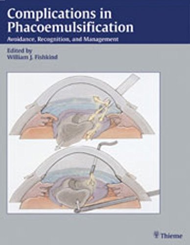 Complications in Phacoemulsification. Avoidance, Recognition, and Management. by William J ...