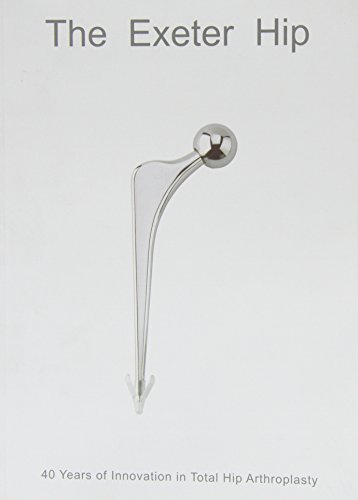 The Exeter Hip: 40 Years of Innovation in Total Hip Arthroplasty by ...