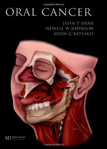 Oral Cancer by Jatin P. M.D.;Johnson Newell W.;Batsaki John Shah ...