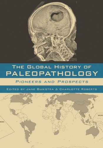 The Global History of Paleopathology: Pioneers and Prospects by ...