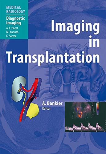 Imaging in Transplantation by Alexander A. Bankier | Goodreads