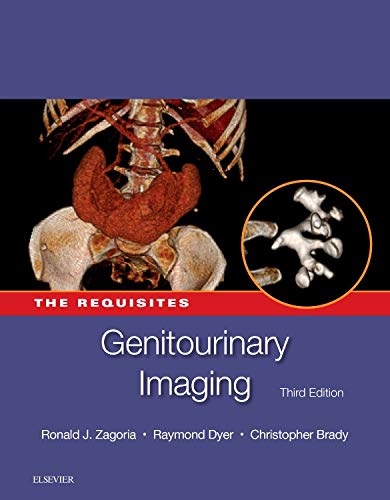 Genitourinary Imaging: The Requisites E-Book: Genitourinary Imaging ...