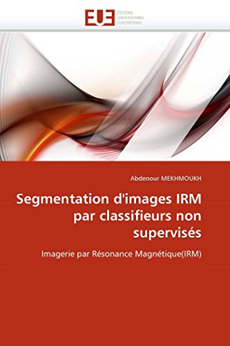 Segmentation d'images IRM par classifieurs non supervisés: Imagerie par ...