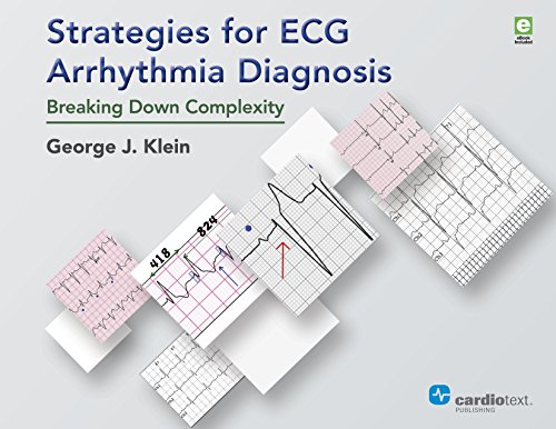 Strategies for ECG Arrhythmia Diagnosis: Breaking Down Complexity by George J. Klein | Goodreads