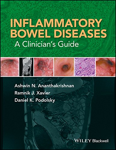 Inflammatory Bowel Diseases: A Clinician's Guide by Ashwin N ...