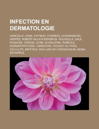 Infection En Dermatologie: Varicelle, Zona, Syphilis, Charbon ...