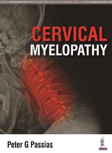 Cervical Myelopathy by Peter Passias | Goodreads