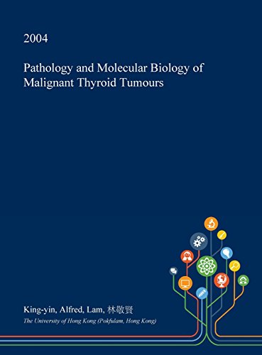 Pathology and Molecular Biology of Malignant Thyroid Tumours by King ...
