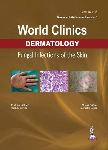 World Clinics Dermatology: Fungal Infections of the Skin by Rashmi ...