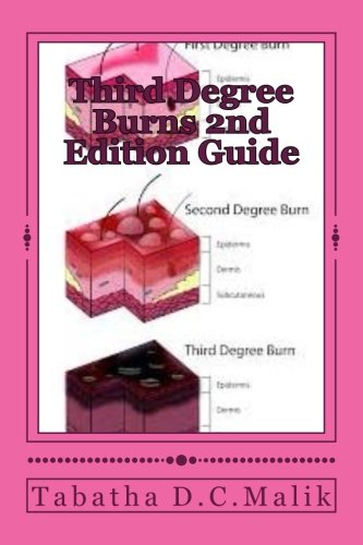 Third Degree Burns 2nd Edition Guide: Third Degree Burns 2nd Limited ...