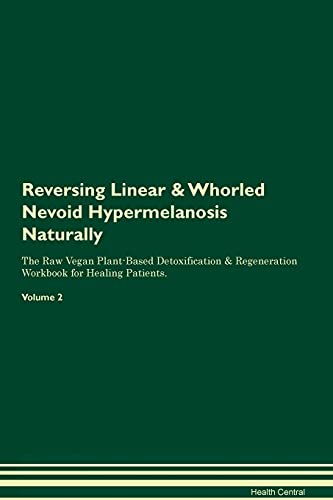 Reversing Linear & Whorled Nevoid Hypermelanosis Naturally The Raw ...