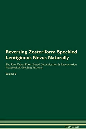 Reversing Zosteriform Speckled Lentiginous Nevus Naturally The Raw ...