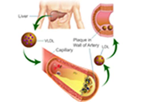 Estimation of Blood LDL Cholesterol and VLDL Cholesterol by Seema Shah ...
