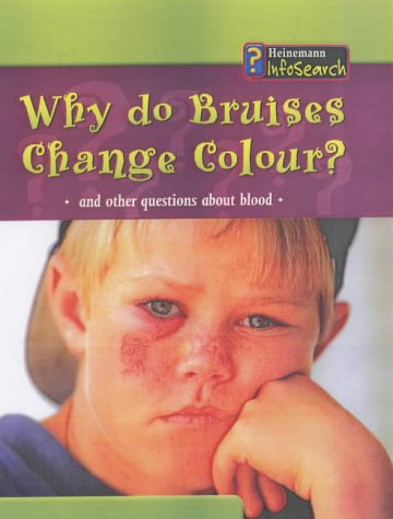 Why Do Bruises Change Colour? (Body Matters) by Angela Royston | Goodreads
