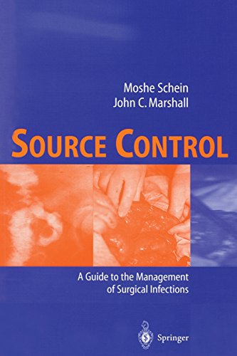 Source Control by Moshe Schein | Goodreads